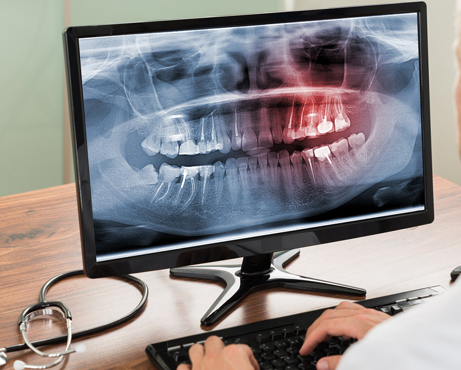 Dental Technology – Heine & Associates Family Dentistry